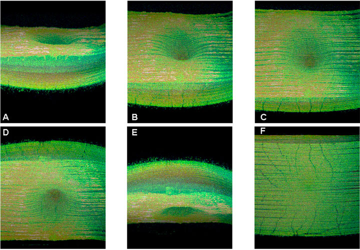 Quantum-dot diodes provide sources for optical coherence tomography ...